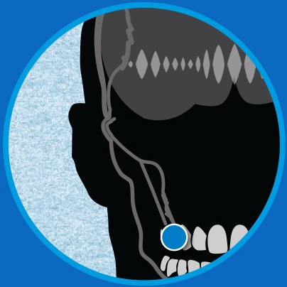 Le "Molar Mic" permettra aux soldats de passer des appels depuis ...